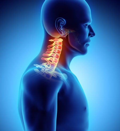 Cervicalgie traitement naturel : la soulager avec Duvamat