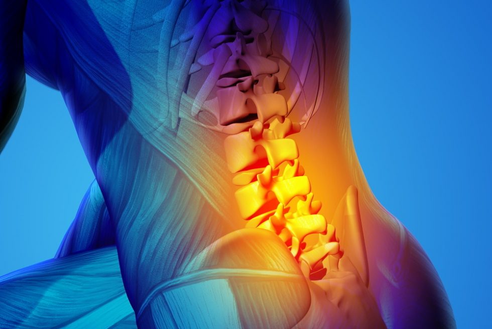 Lombarthrose, arthrose lombaire : comment la soulager efficacement?